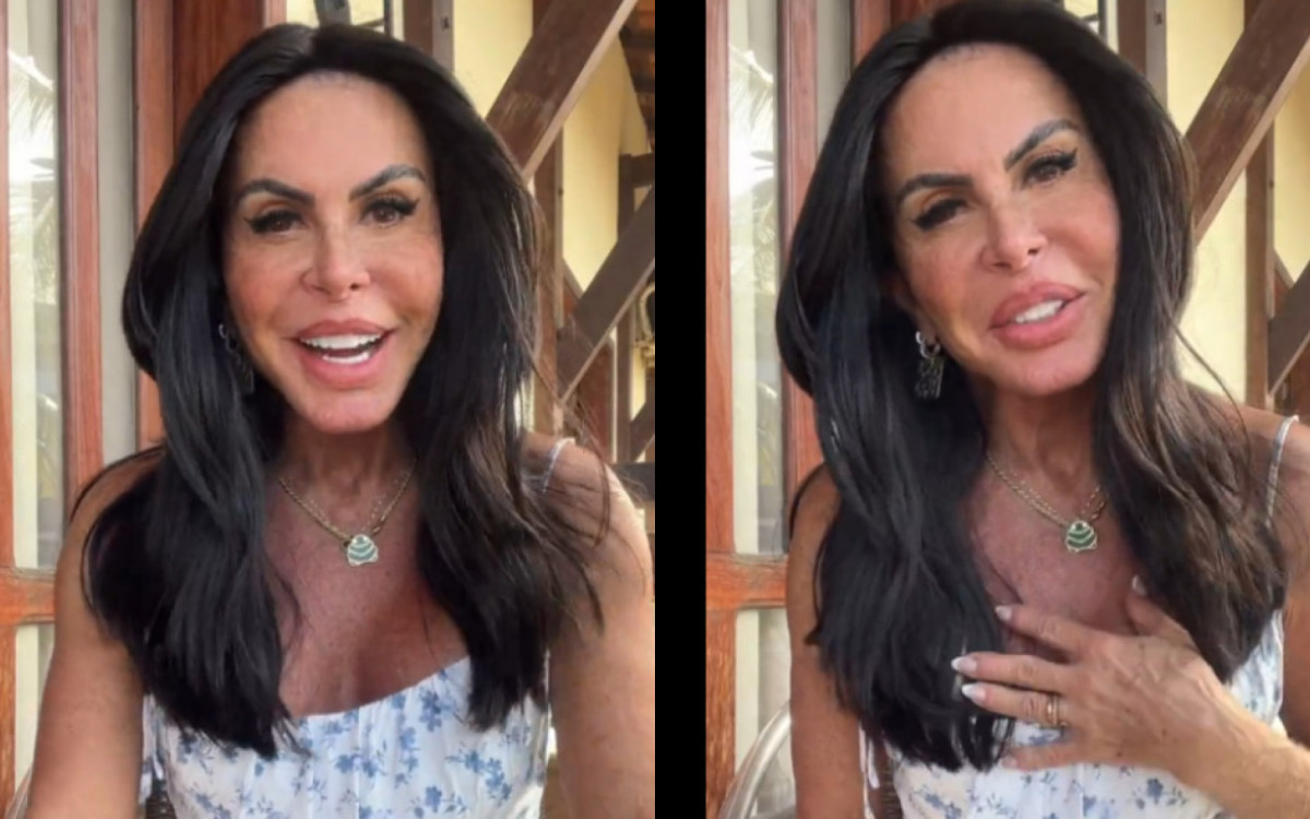 Gretchen surge com novo rosto após harmonização facial e ganha elogios ...