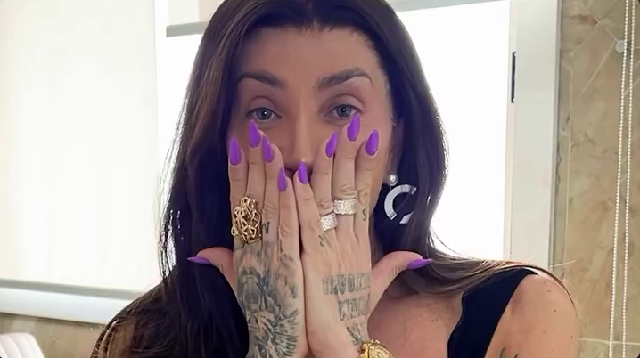 Maya Massafera mostra o rosto pela primeira vez após retirada de ossos ...